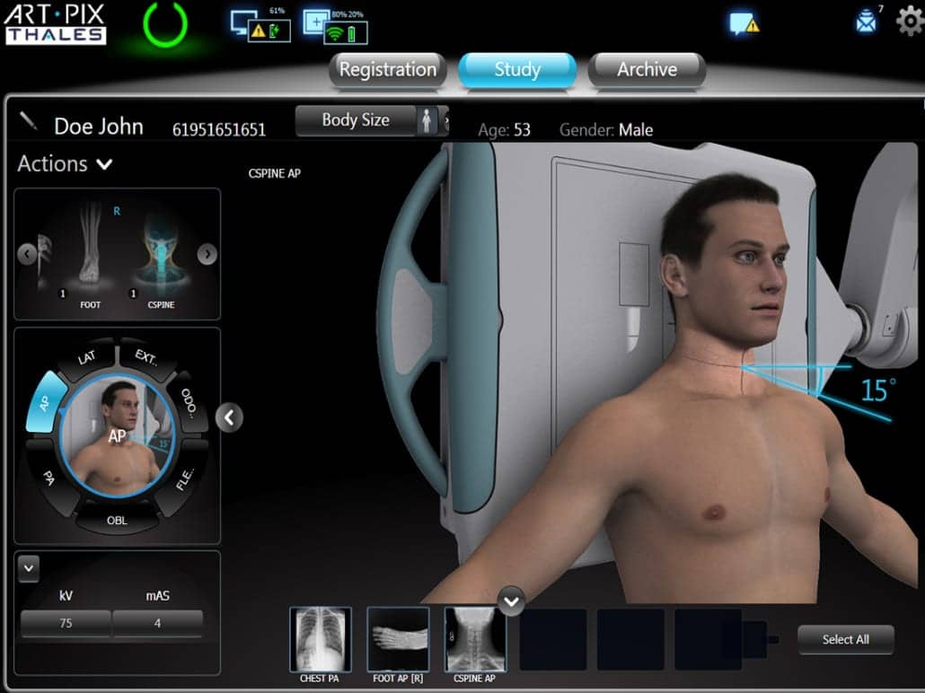 ArtPix Mobile EZ2GO Offers Wireless Digital Radiography