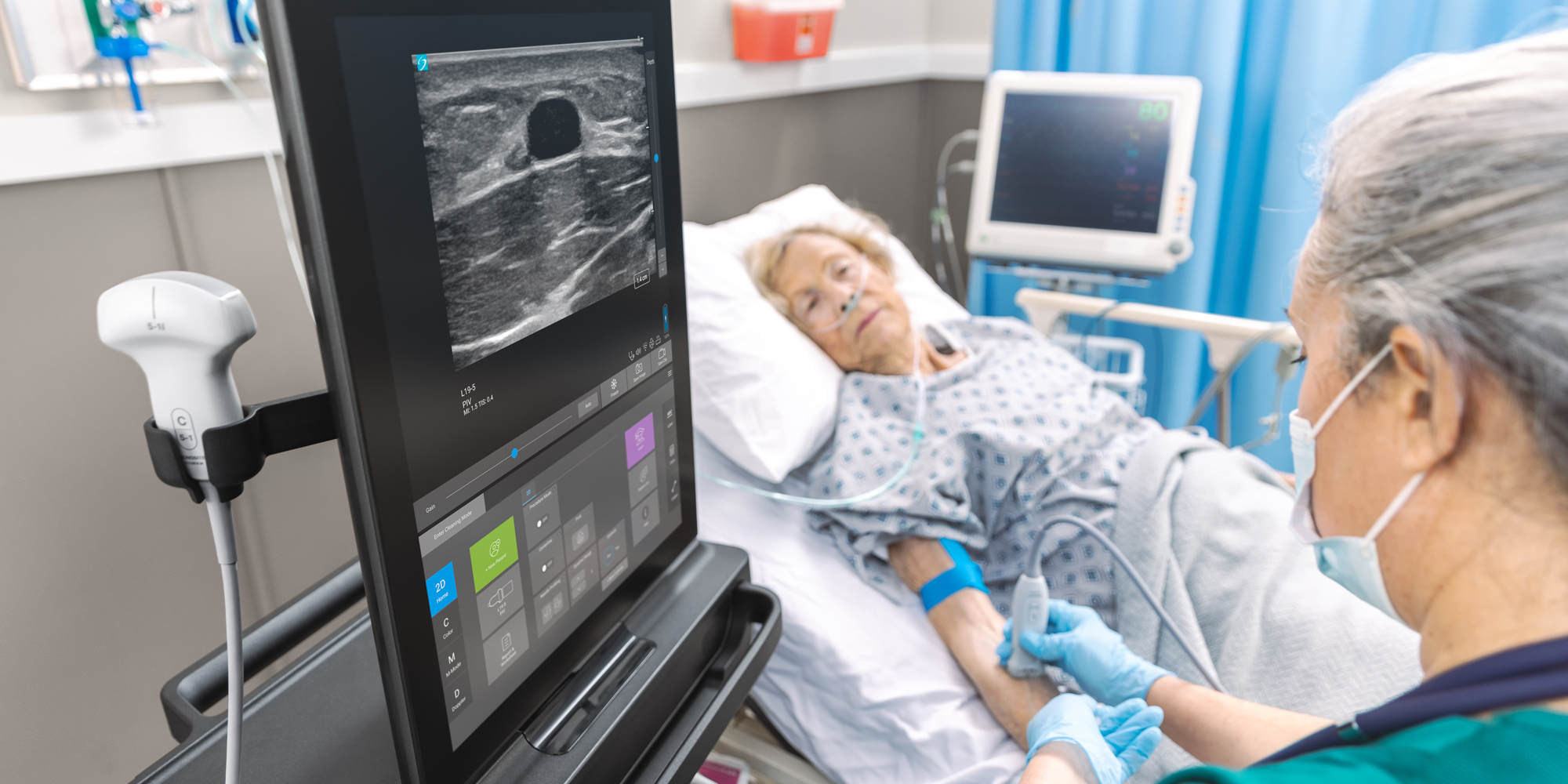 Fujifilm Sonosite Launches All-Touchscreen Sonosite ST POCUS System