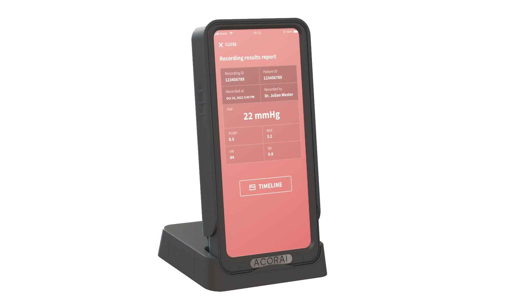 Acorai Heart Monitor Granted FDA Breakthrough Designation