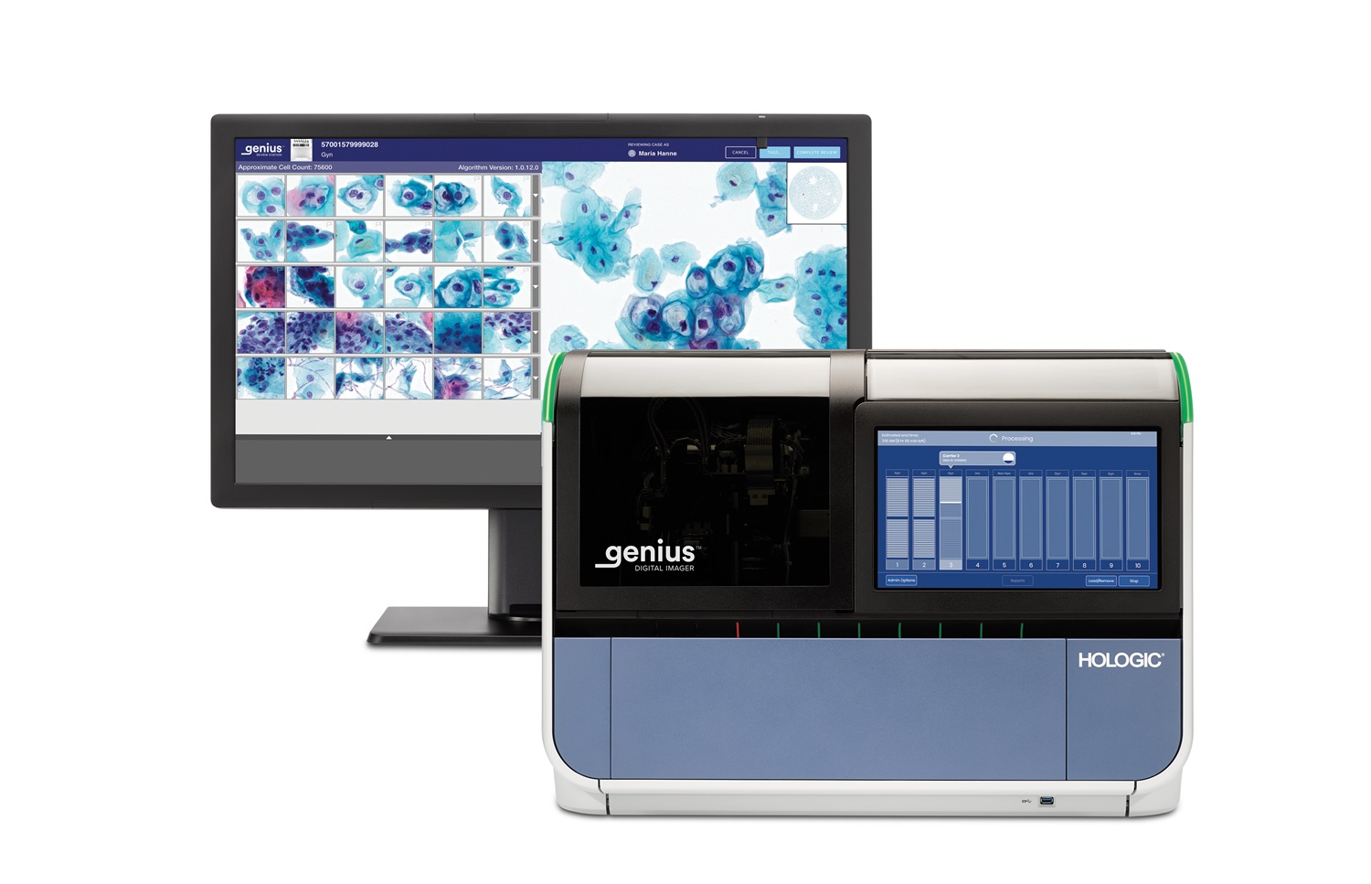 FDA Clears Hologic’s Genius Digital Diagnostics System