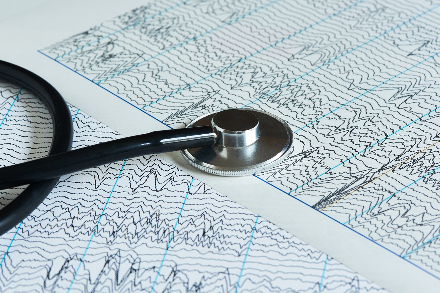 FDA Clears Epitel's REMI Technologies for EEG Monitoring