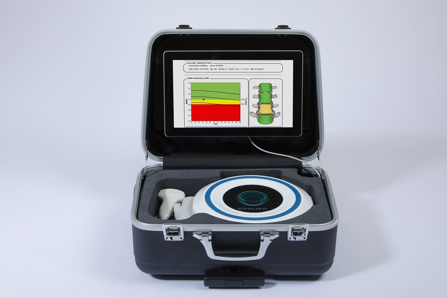 NASA Uses Echolight's REMS to Monitor Bone Density in Study
