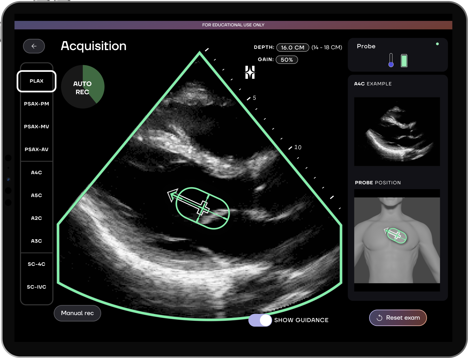 HeartFocus Launches AI Cardiac Imaging Software in US with Butterfly ...