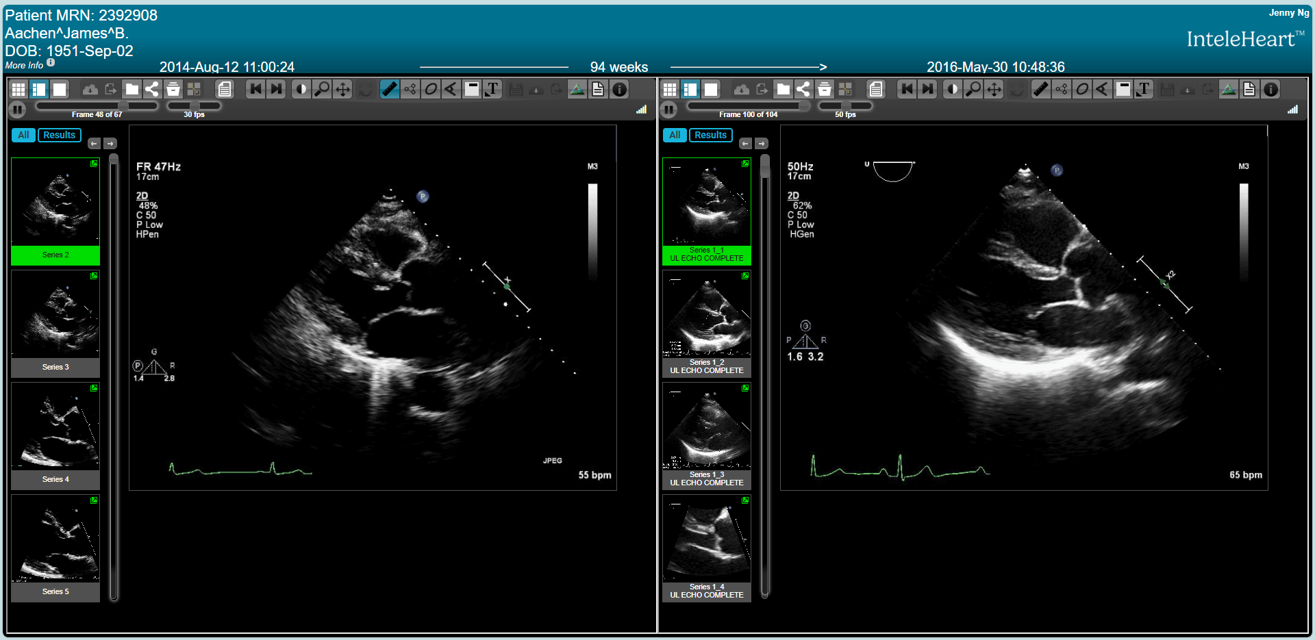 Next-Gen Cardiology Platform Consolidates Imaging, Reporting, and Workflows