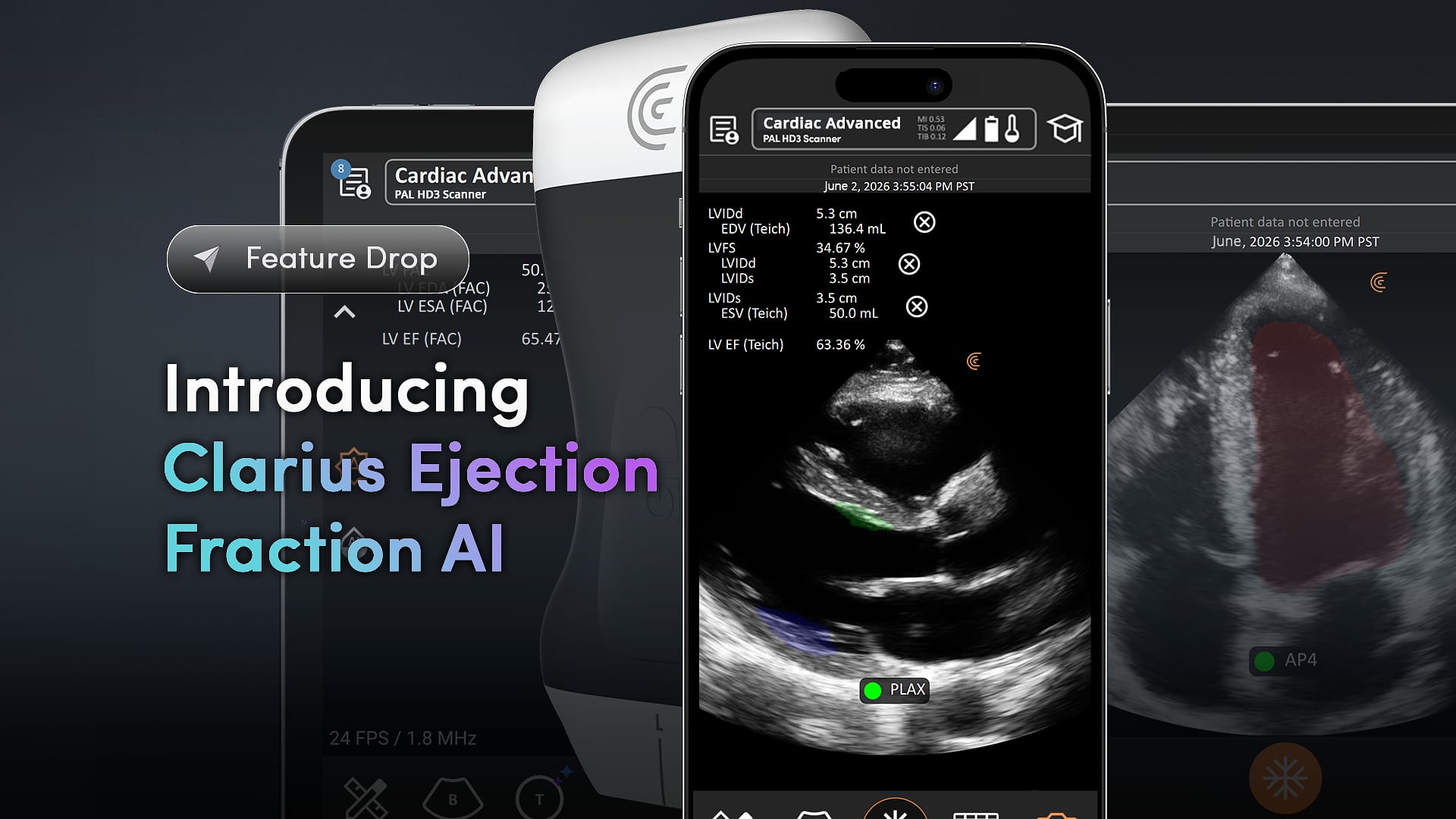 FDA Clears New AI Tool for Cardiac Ultrasound Assessments